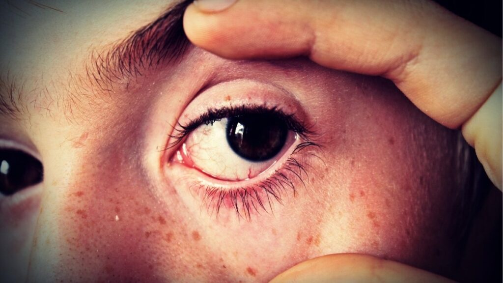10 Prime Causes Of Eye Disorders