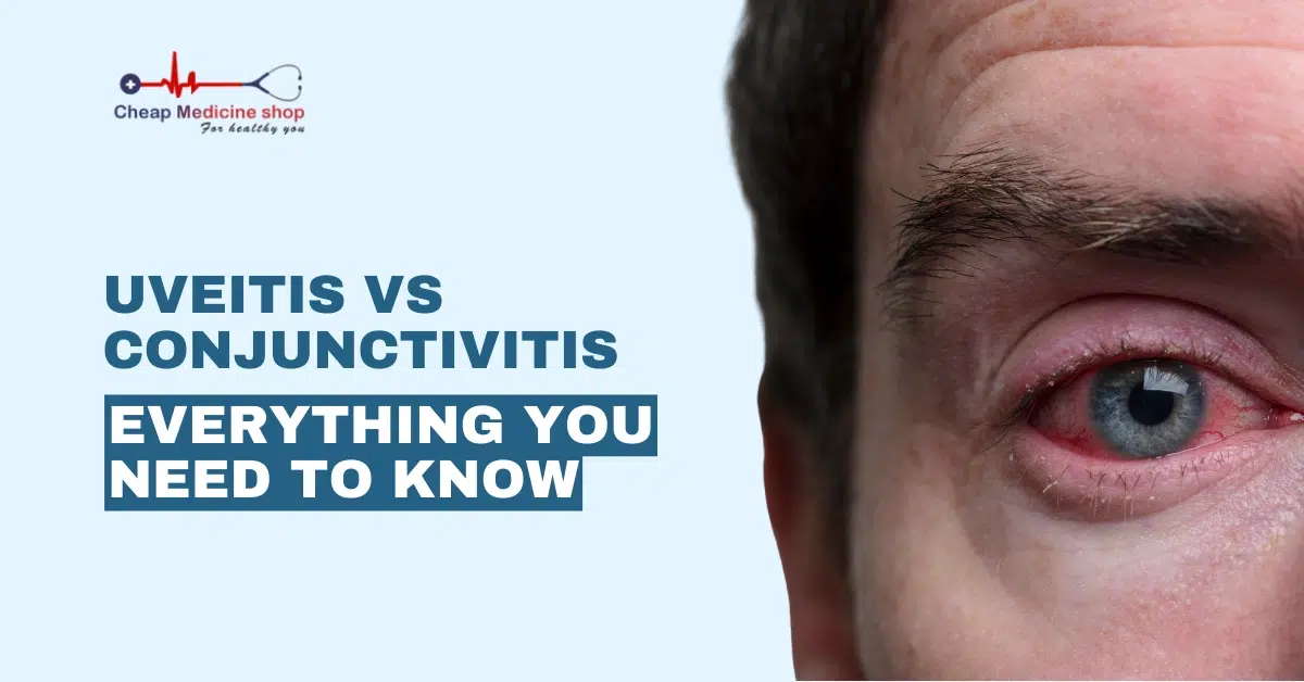 difference between uveitis and conjunctivitis Archives ...